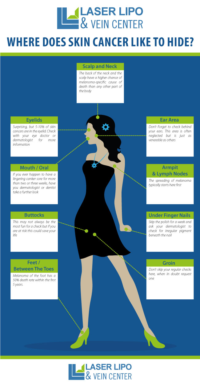 Skin Cancer Screening and Treatment in St. Louis | Laser Lipo and Vein ...