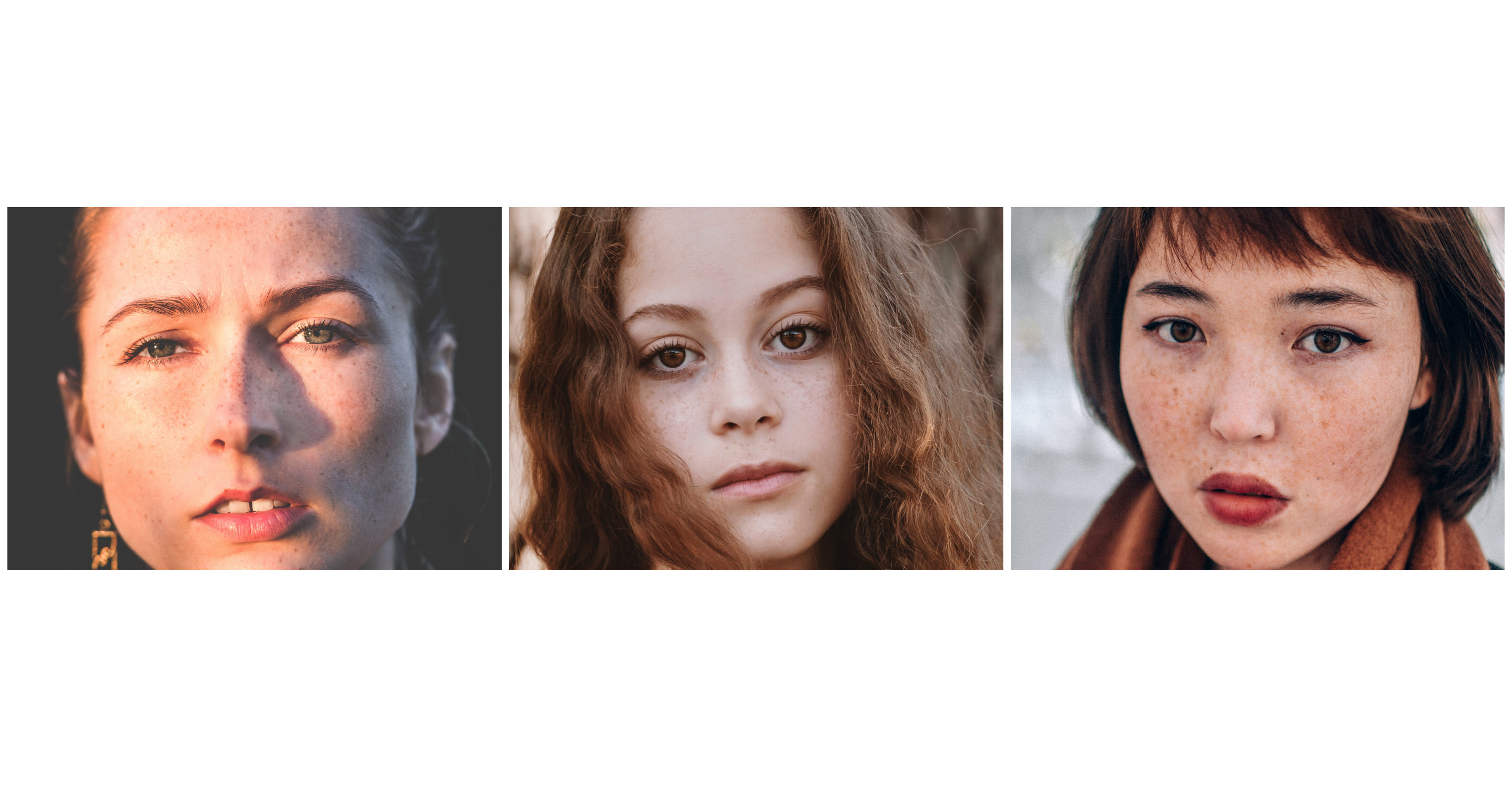 SaltFacial in St Louis | Laser Lipo and Veins