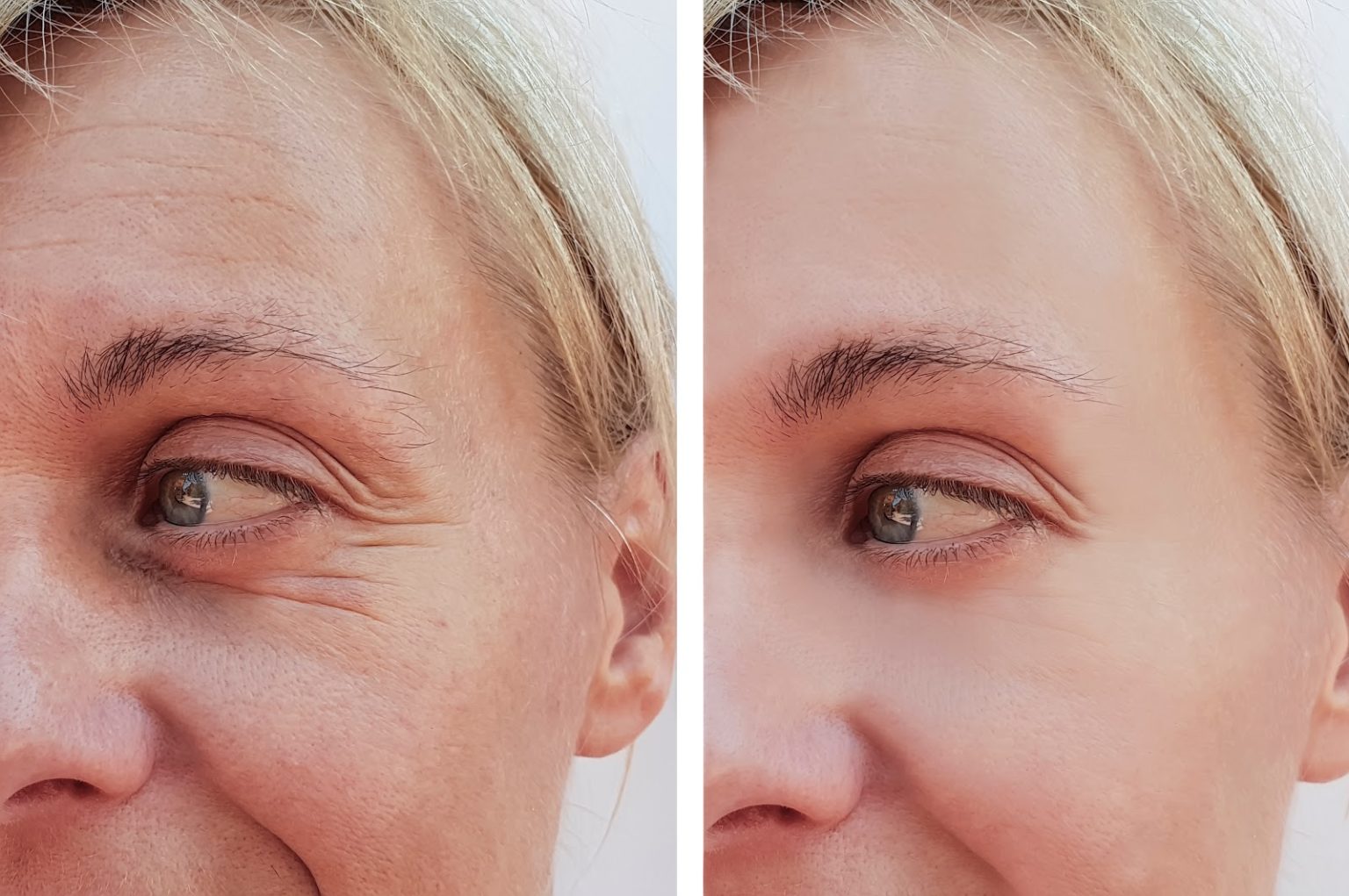 Learn About Our 6 Steps of Prejuvenation | Laser Lipo and Veins