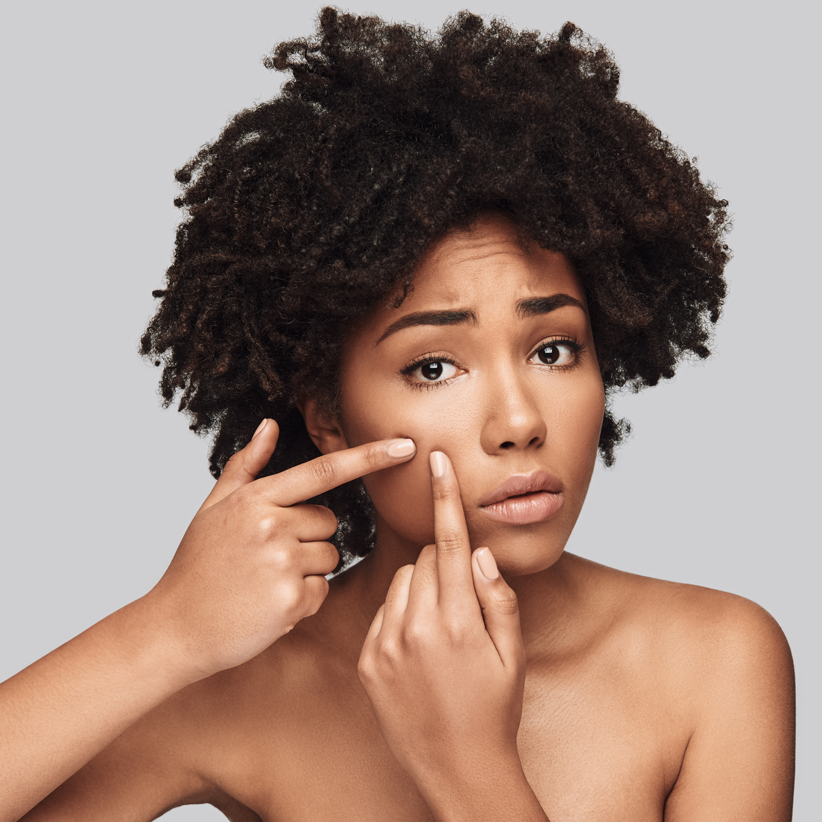 Learn All About Our Acne Treatment Options | Laser Lipo and Veins