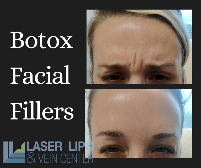 St Louis Cosmetic BOTOX Injections For Wrinkles | Laser Lipo & Veins