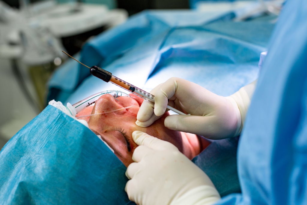 Fat Grafting for Facial Rejuvenation | Laser Lipo and Veins