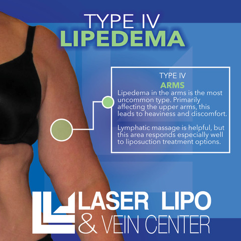 Promote Lipedema Awareness Month | Laser Lipo and Veins