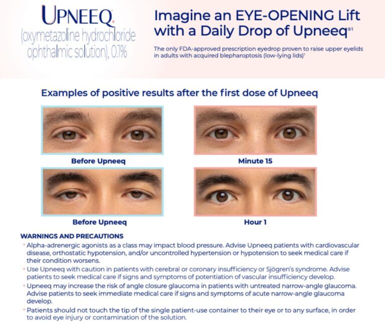 Upneeq | The Innovative Droopy Eyelid Treatment | Laser Lipo and Veins