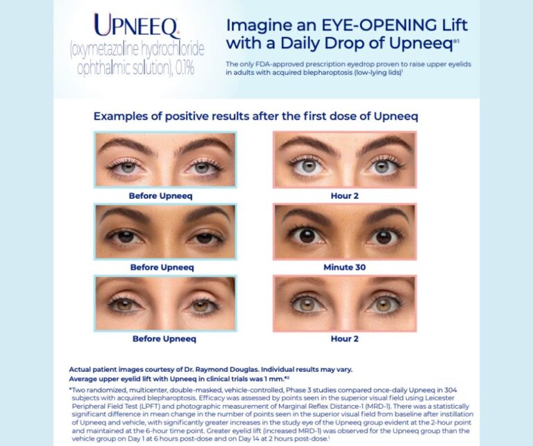 Upneeq | The Innovative Droopy Eyelid Treatment | Laser Lipo and Veins