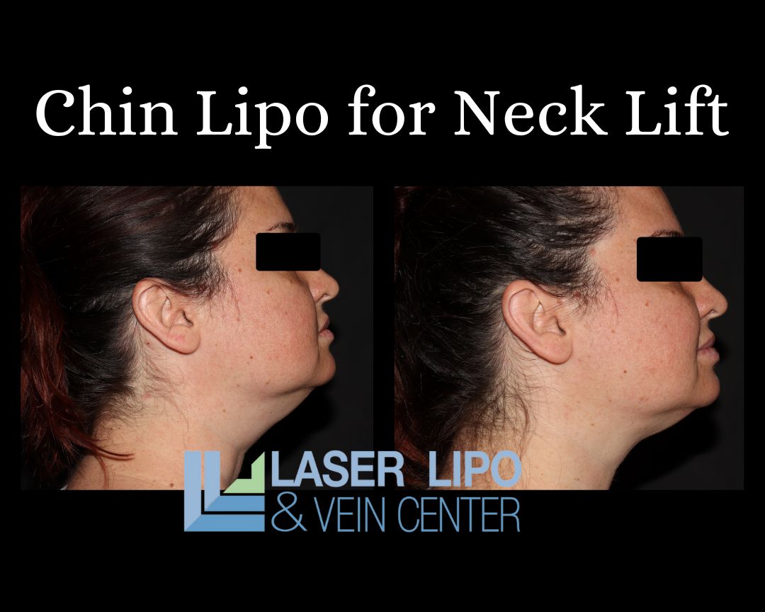 Read These 5 Skin Cancer Prevention Tips | Laser Lipo and Veins