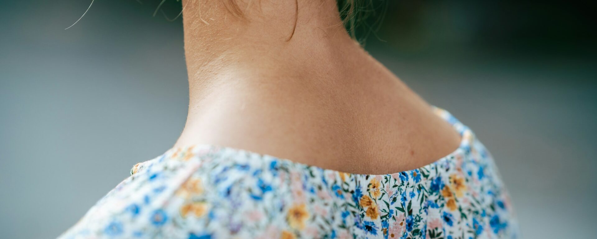 Liposuction on Buffalo Hump as an Effective Treatment | Laser Lipo & Veins